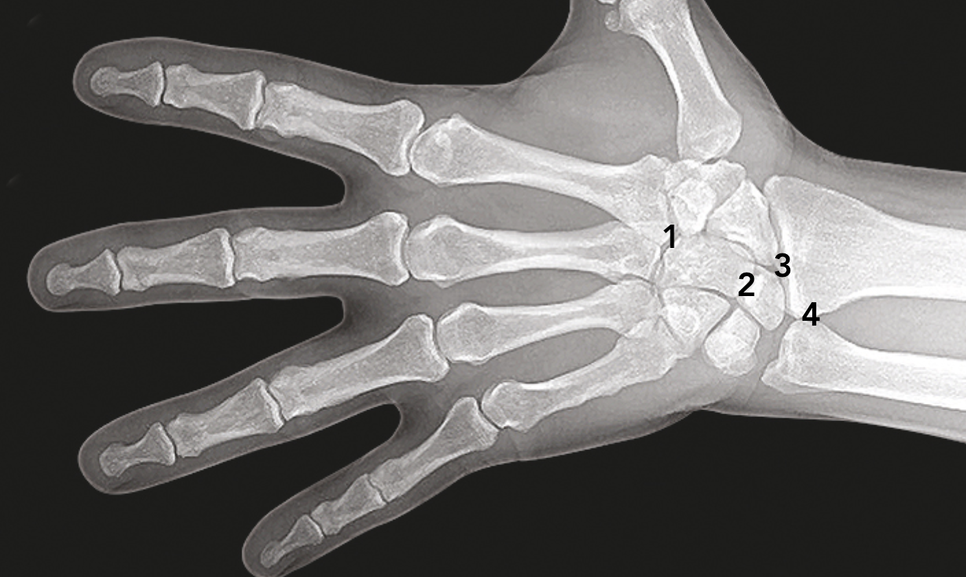 Distal Radioulnar Joint Exam | Anatomic Structures at Risk
